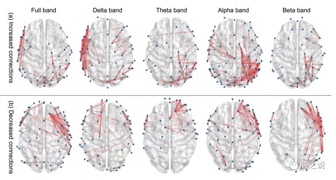 基于EEG功能连接的多变量模式分析：抑郁症的分类研究_采用相滞指数(phase lag index,pli)来计算两两通道信号之间的功能连接 ...