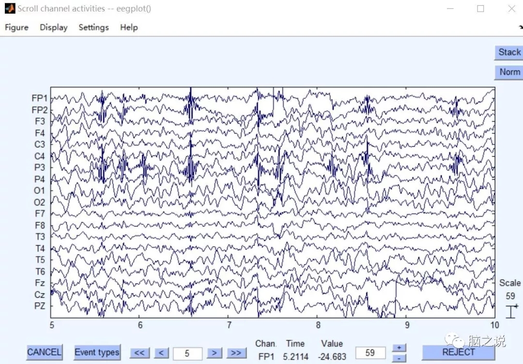 如何利用EEGlab工具包在EEG数据中手动插入Marker？_eeglab 手动打点-CSDN博客