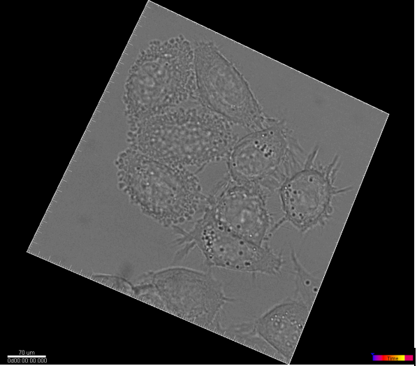 【计算机视觉】基于Yolov5+Kalman Filter的多细胞追踪（CELL TRACKING CHALLENGE）_yolo ...
