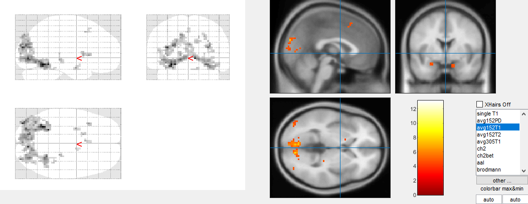 基于DPABI和SPM12的任务态fMRI分析笔记2——统计检验_fmri任务态分析-CSDN博客