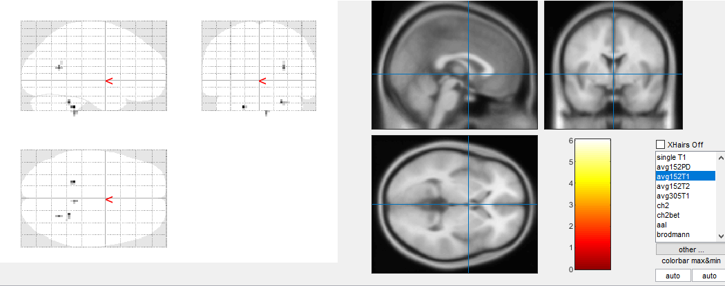 基于DPABI和SPM12的任务态fMRI分析笔记2——统计检验_fmri任务态分析-CSDN博客