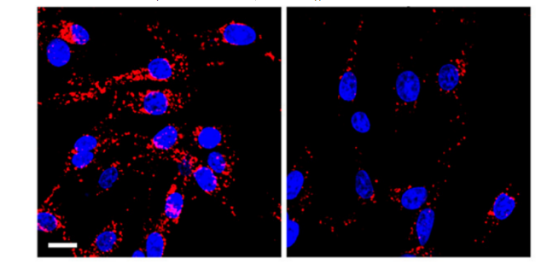 外泌体标记检测亲脂性染料 :PKH-67（green）/PKH-26（red）_pkh67标记外泌体-CSDN博客