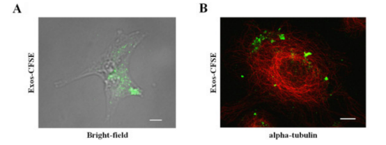 外泌体标记检测亲脂性染料 :PKH-67（green）/PKH-26（red）_pkh67标记外泌体_齐岳生物科技在线的博客-CSDN博客