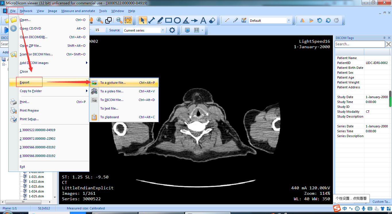 图像格式的批量转换_microdicom 批量翻转-CSDN博客