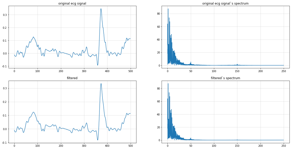 PTB-XL心电信号处理-CSDN博客