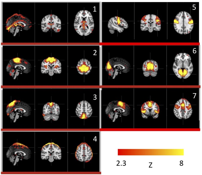 静息状态下的低频全身血液动力学“噪声” BOLD fMRI：特征，原因，含义，缓解及应用（二）_global signal regression (gsr)-CSDN博客