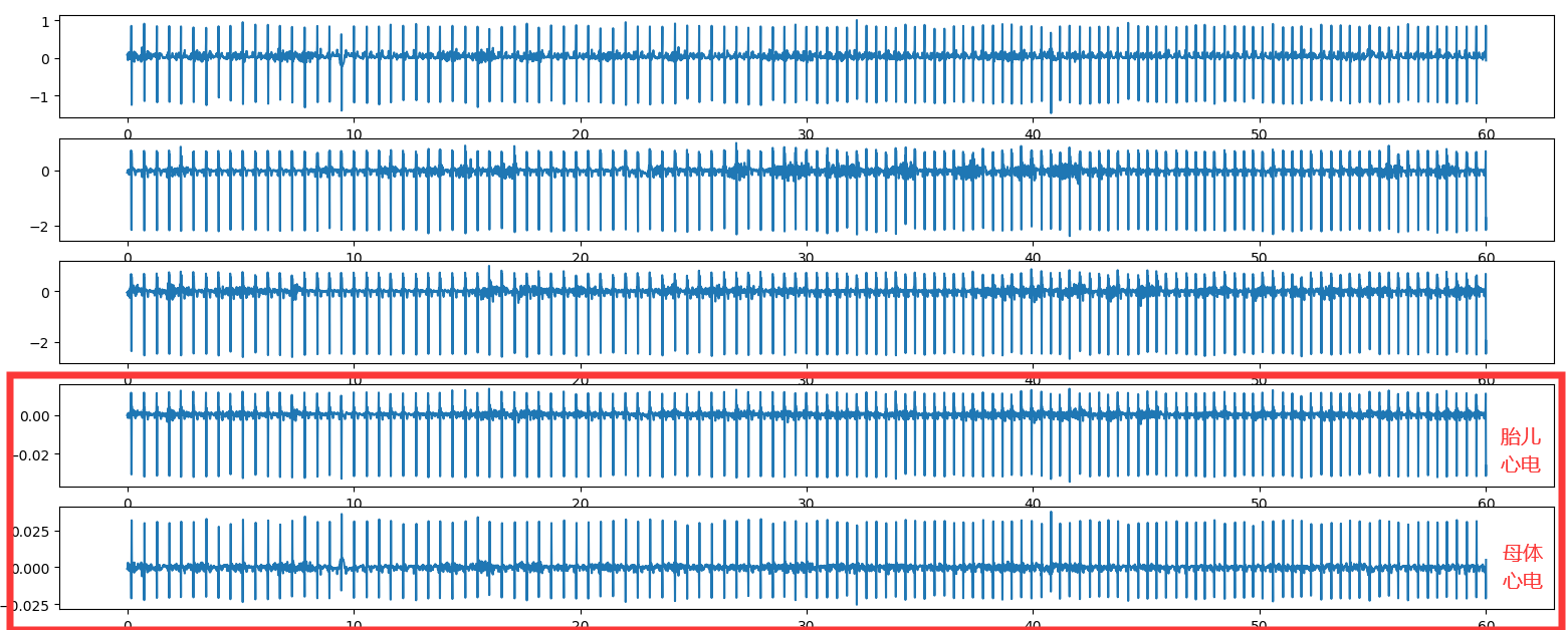 python使用FastICA提取胎儿心电的尝试记录_胎儿心电提取的fastica-CSDN博客