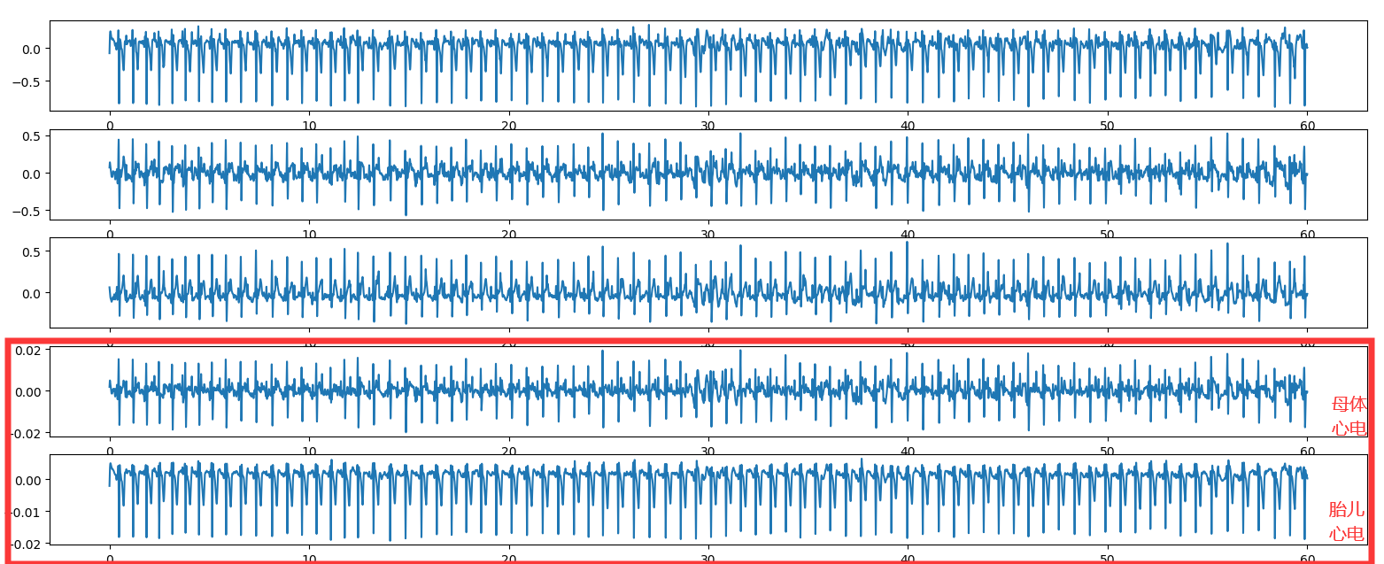 python使用FastICA提取胎儿心电的尝试记录_胎儿心电提取的fastica-CSDN博客
