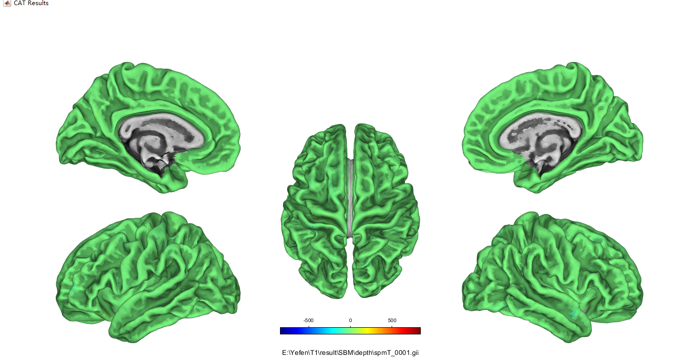 基于cat12搞定SBM的ROI的统计分析——vertex水平和ROI水平的双样本T检验-CSDN博客