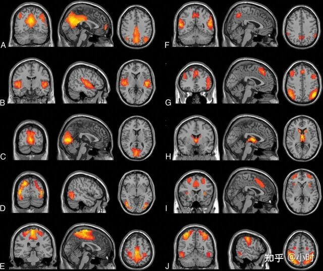 脑机接口专栏 | 如何分析静息状态的fMRI数据？（三）_fmri脑网络单一分析-CSDN博客