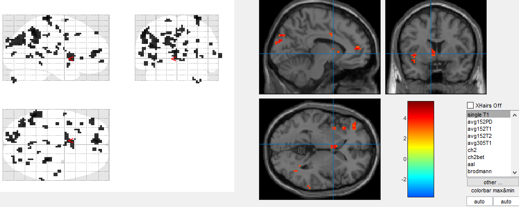 基于DPABI和SPM12的任务态fMRI分析笔记2——统计检验_fmri任务态分析-CSDN博客
