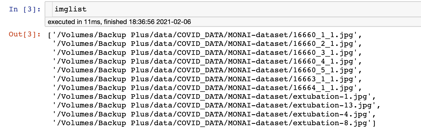 MONAI中，一定要学会的三种Dataset使用方法_%load image rgb 3-d data set-CSDN博客