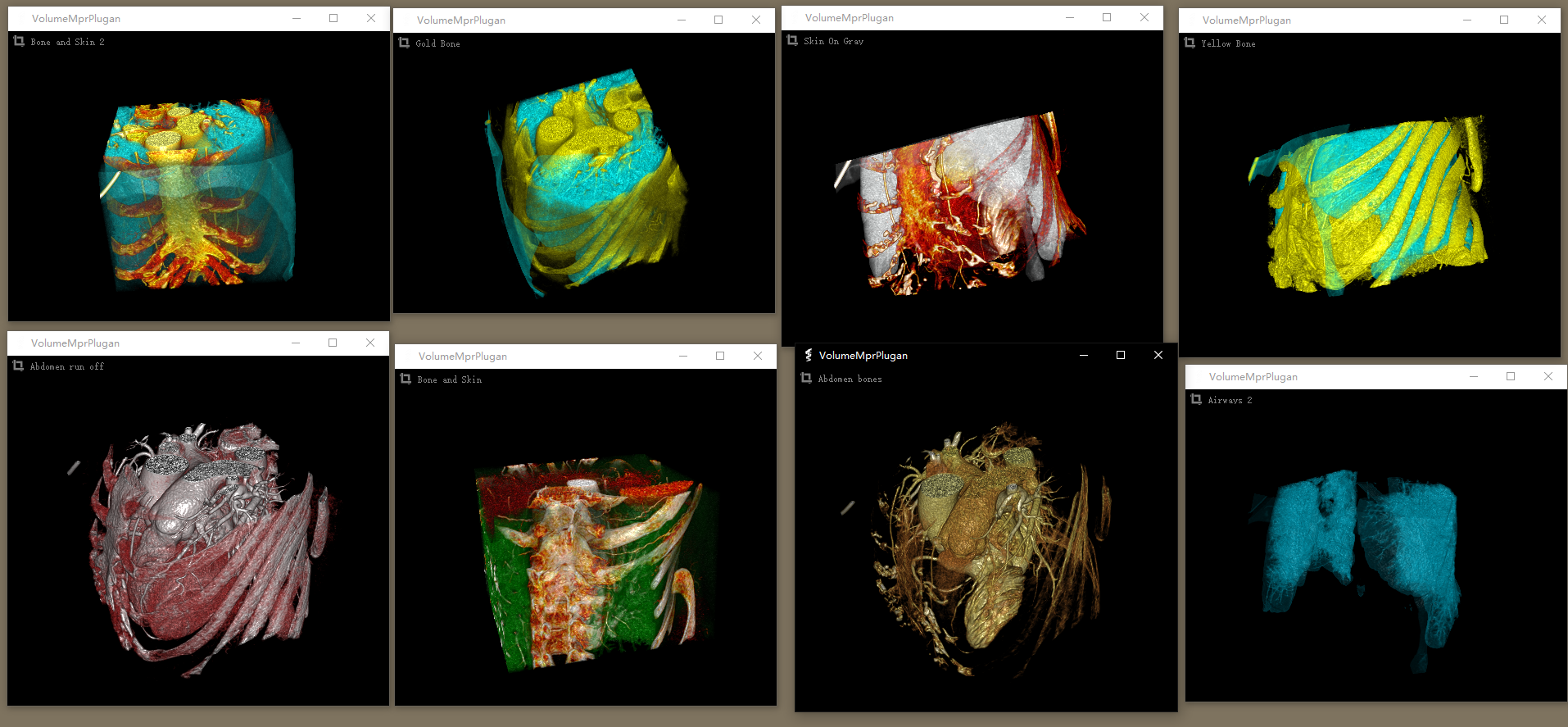 KISS Dicom Viewer 体渲染插件（利用vtk Volume 实现体渲染）_vtk 小蚂蚁-CSDN博客