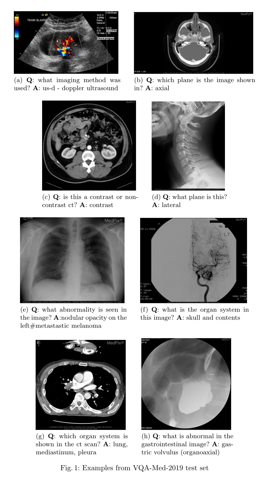【VQA文献阅读】VQA-Med: Overview of the Medical Visual Question Answering ...