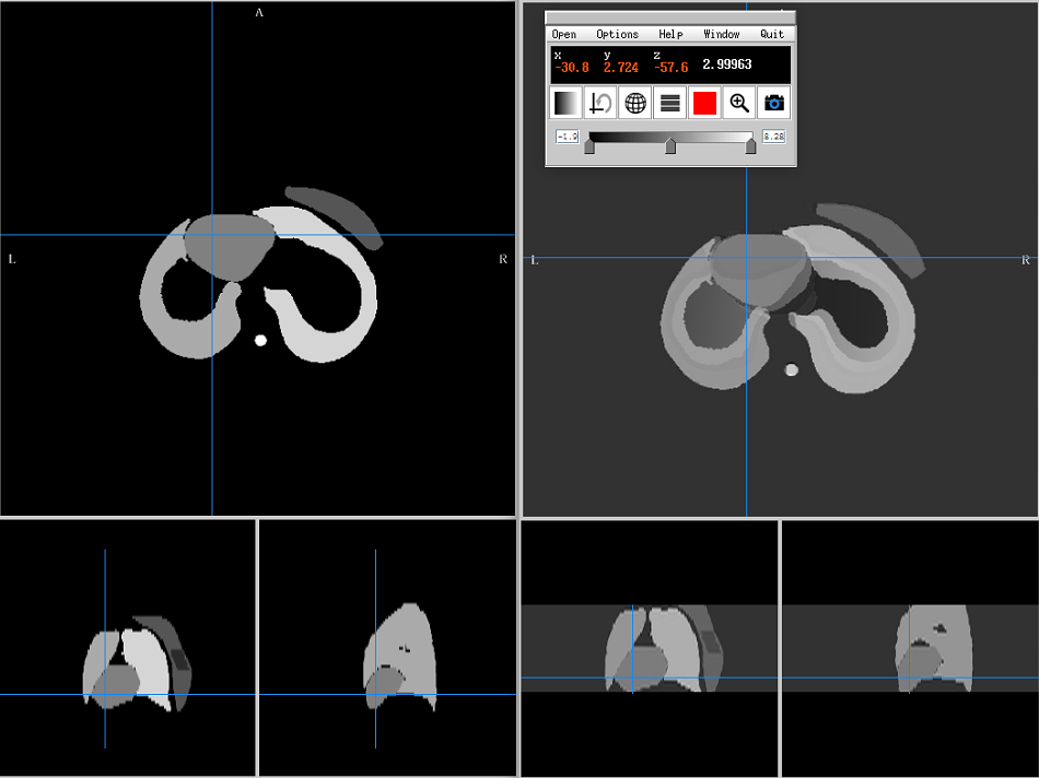 医学图像配准工具SimpleElastix和Elastix的使用——解决参数文件的重采样插值方式(ResampleInterpolator)的影响_elastix 参数文件-CSDN博客