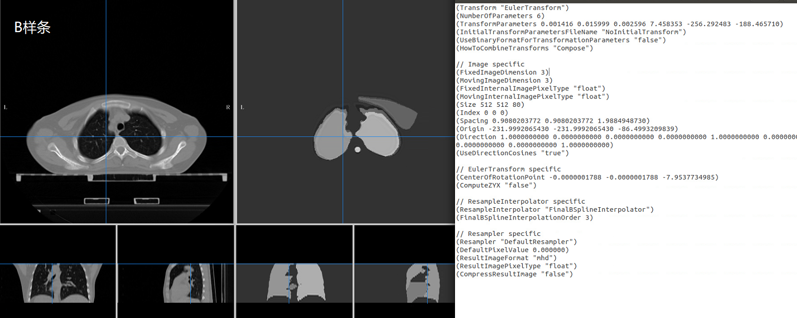 医学图像配准工具SimpleElastix和Elastix的使用——解决参数文件的重采样插值方式(ResampleInterpolator)的影响_elastix 参数文件-CSDN博客