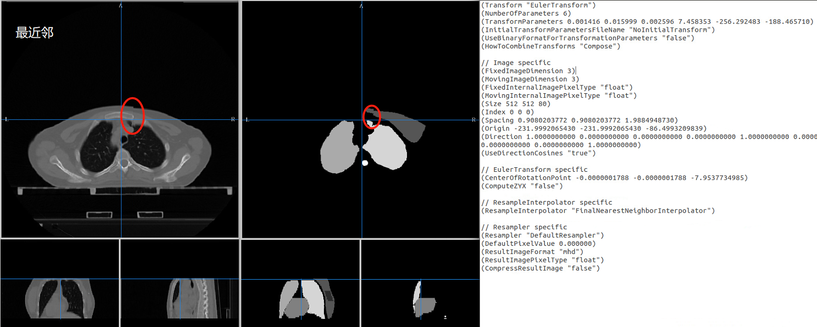 医学图像配准工具SimpleElastix和Elastix的使用——解决参数文件的重采样插值方式(ResampleInterpolator)的影响_elastix 参数文件-CSDN博客