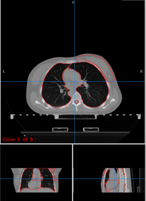 医学图像配准工具SimpleElastix和Elastix的使用——解决参数文件的重采样插值方式(ResampleInterpolator)的影响_elastix 参数文件-CSDN博客
