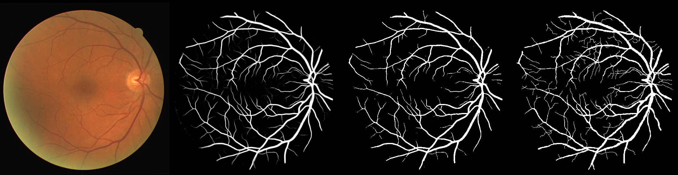 视网膜血管分割代码pytorch实现vesselseg Pytorch Csdn博客 