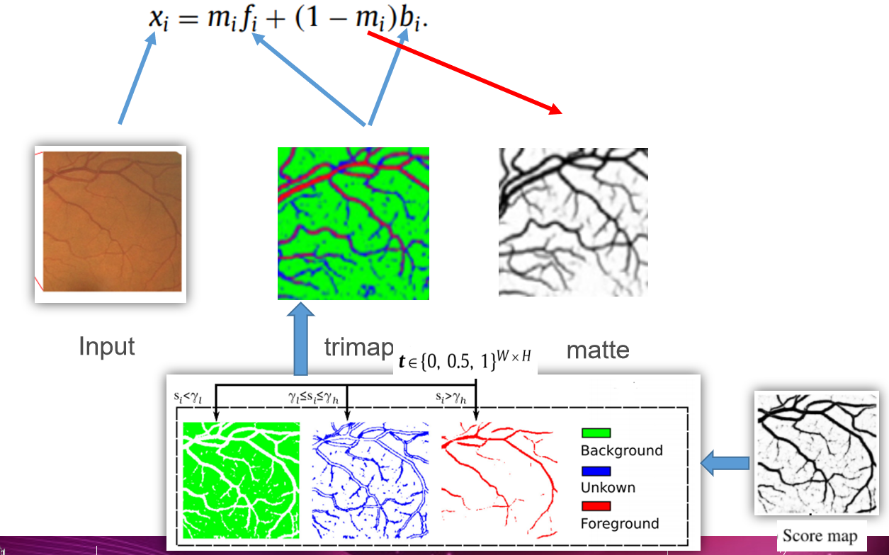 【论文】Improving retinal vessel segmentation with joint local loss by ...