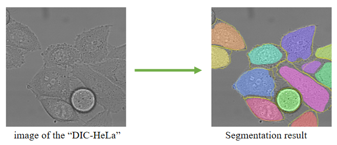 【论文】U-Net: Convolutional Networks for Biomedical Image Segmentation-CSDN博客