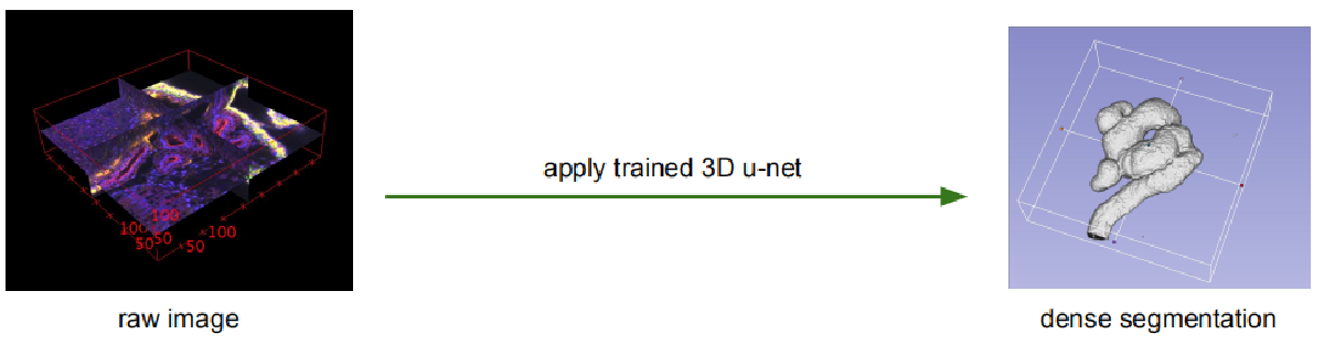 【论文】3D U-Net: Learning Dense Volumetric Segmentation from Sparse ...