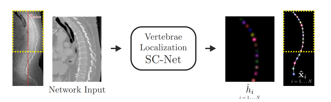 Coarse to Fine Vertebrae Localization and Segmentation论文笔记_spatialconfiguration-net-CSDN博客