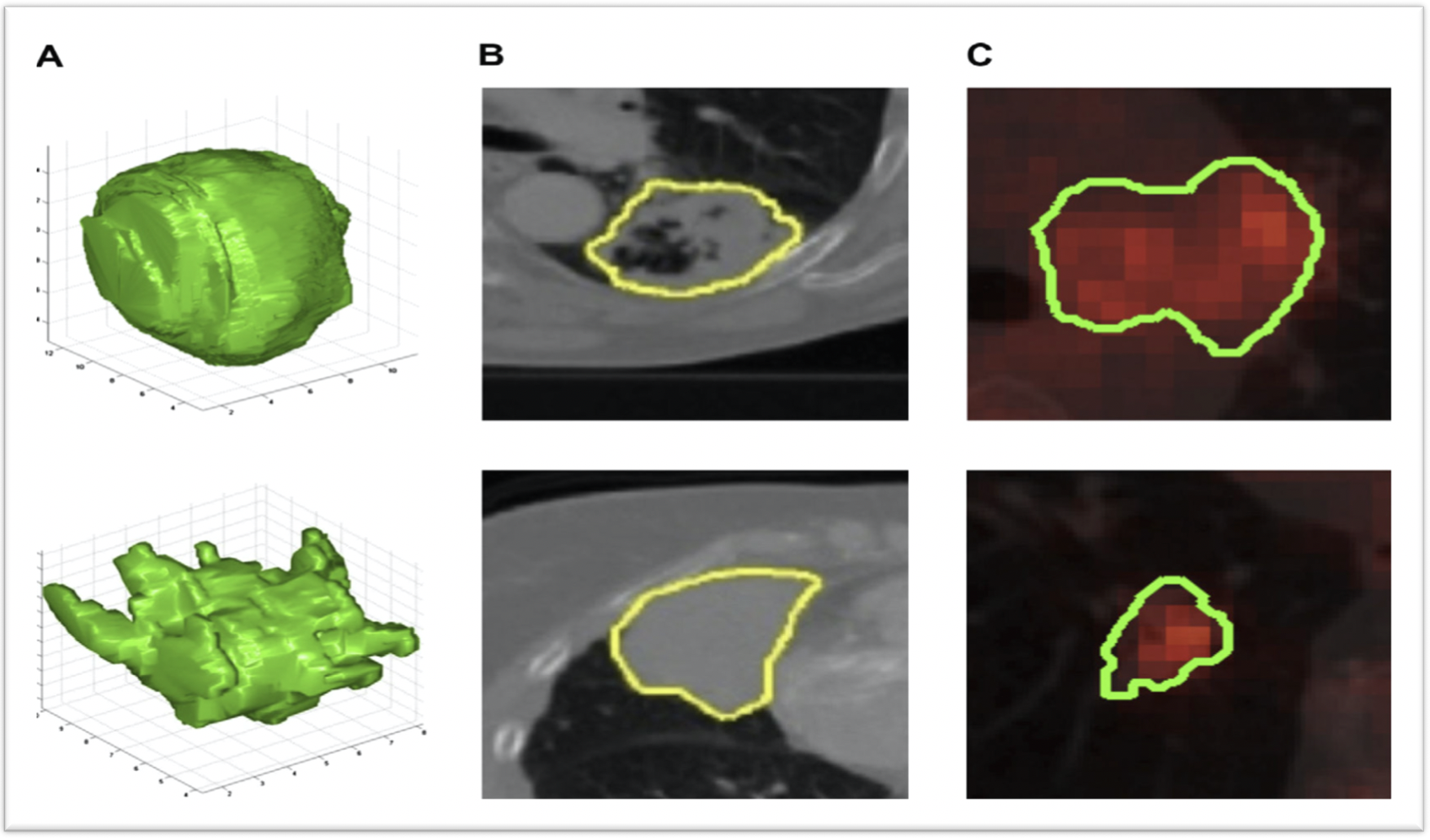 【影像组学导论】第一部分：官方定义解读。这咋整？读懂这个频道就够了！_影像组学 rad score怎么求-CSDN博客