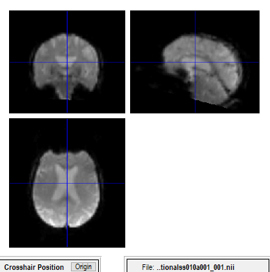基于SPM12对fMRI数据进行预处理及其批处理_spm12 fmri_赤井的博客-CSDN博客