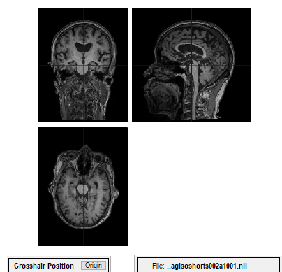 基于SPM12对fMRI数据进行预处理及其批处理_spm12 如何批处理_赤井的博客-CSDN博客