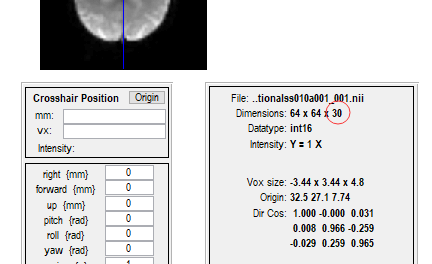基于SPM12对fMRI数据进行预处理及其批处理_赤井的博客-CSDN博客_spm12预处理