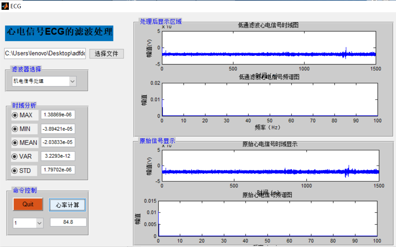 【心电信号】基于matlab Gui心电信号数字滤波处理【含matlab源码 1067期】 Matlab心电信号滤波 Csdn博客