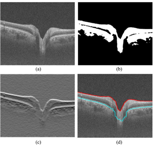 Automatic Optic Disc Detection in OCT Slices via Low-Rank ...