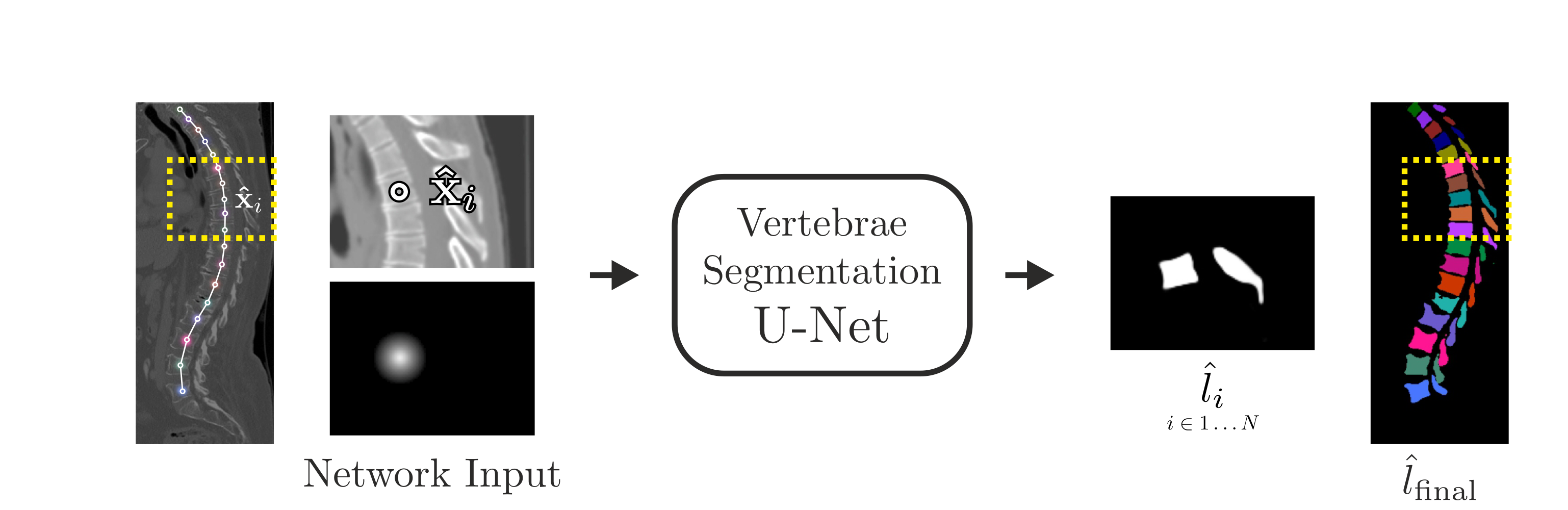 Coarse to Fine Vertebrae Localization and Segmentation论文笔记_spatialconfiguration-net-CSDN博客