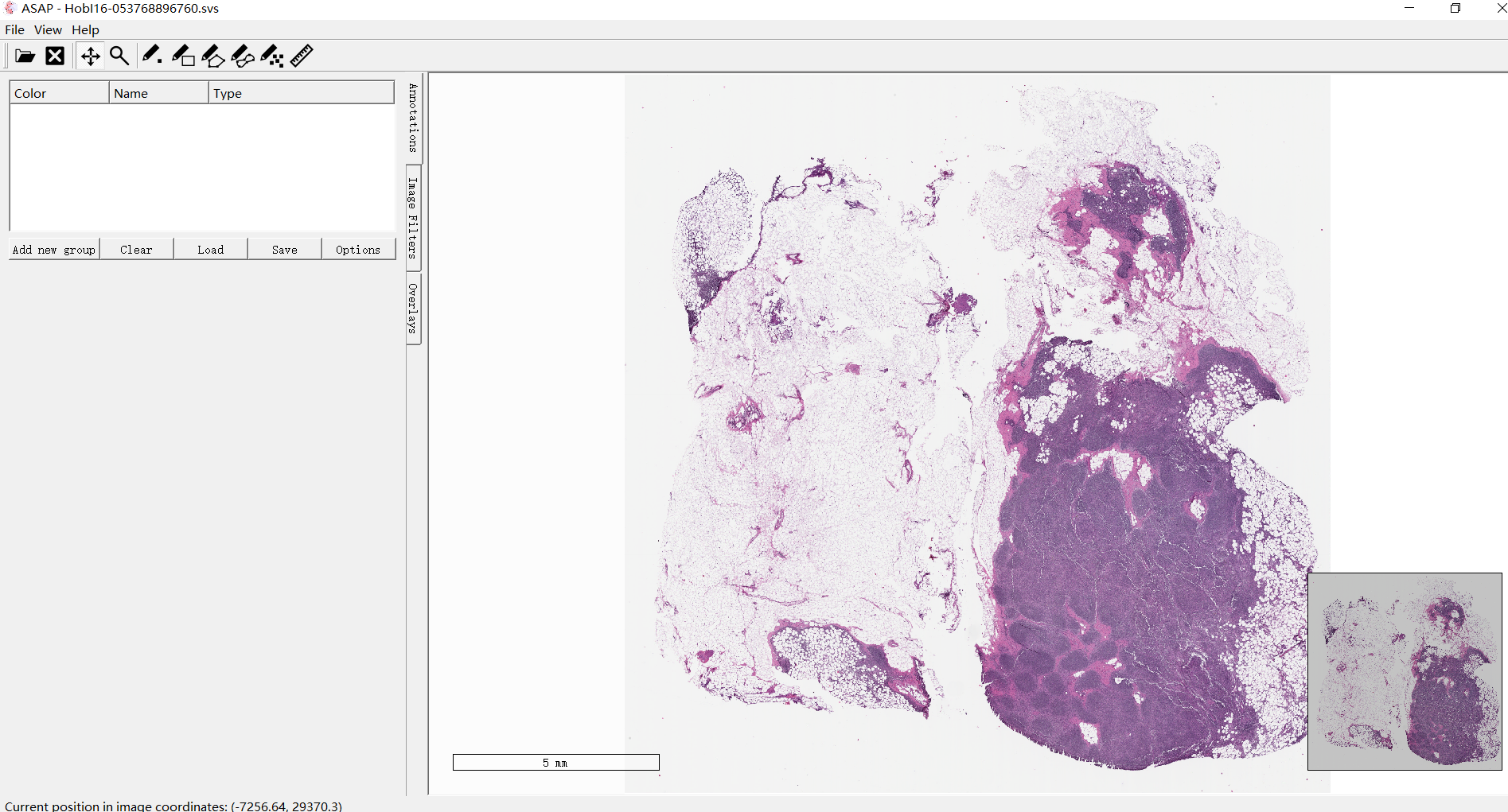 windows安装ASAP（ Automated Slide Analysis Platform）【实测成功】_windows 安装asap-1.9-CSDN博客