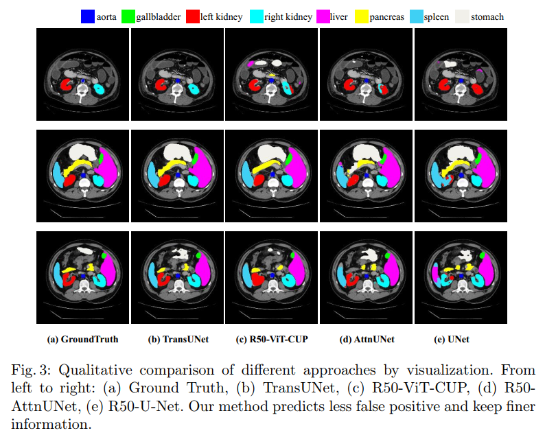 TransUNet: Transformers Make Strong Encoders for Medical Image Segmentation （transformer + unet ...