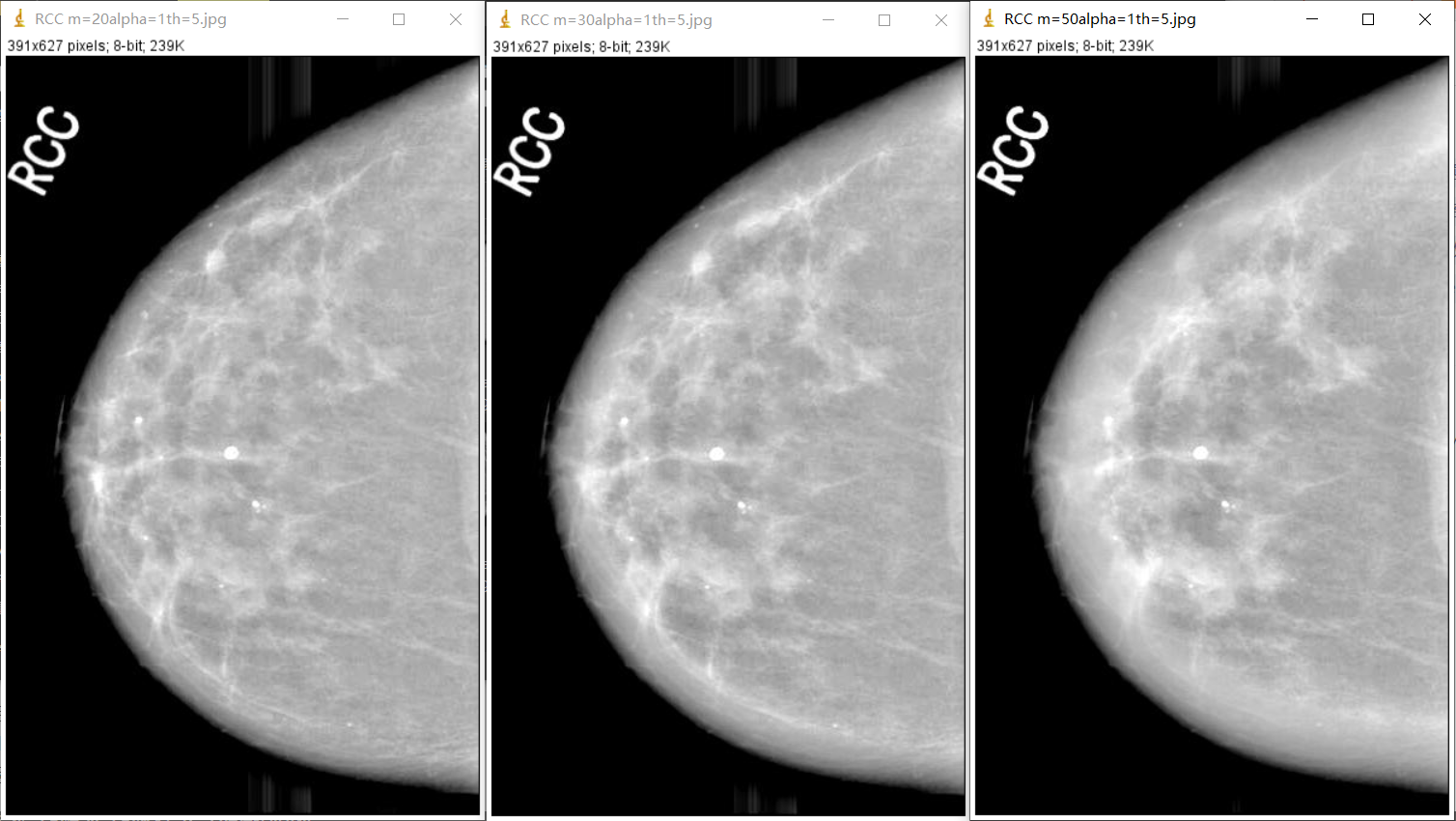 Adaptive Contrast Enhancement（ACE）自适应对比度增强 附MATLAB代码-CSDN博客