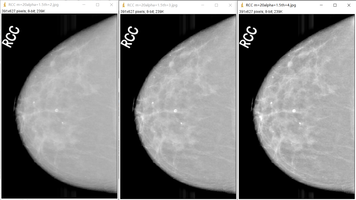 Adaptive Contrast Enhancement（ACE）自适应对比度增强 附MATLAB代码-CSDN博客