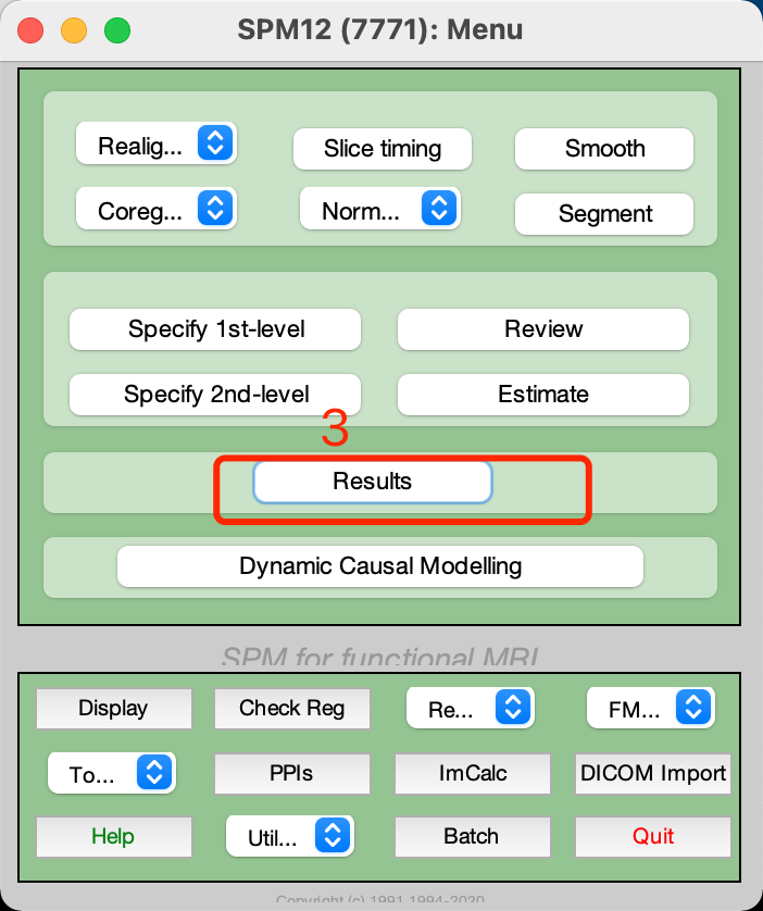 利用CAT12做皮层指标的统计分析及可视化笔记记录_长腿猴子请来的救兵的博客-CSDN博客