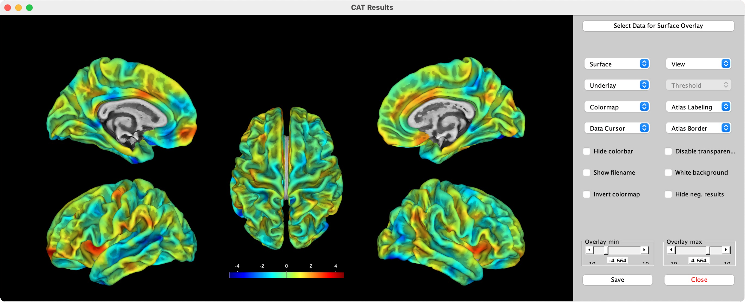 利用CAT12做皮层指标的统计分析及可视化笔记记录_长腿猴子请来的救兵的博客-CSDN博客