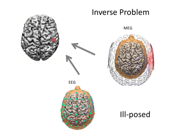 脑电溯源分析/源定位 EEG source analysis / Localization-CSDN博客