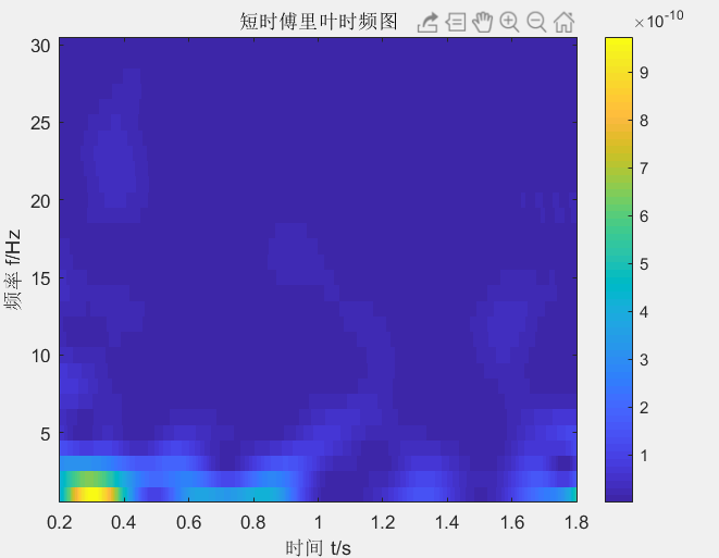 spectrogram（频谱图函数）matlab使用STFT参数选择以及滑动窗的问题_matlab spectrogram函数-CSDN博客