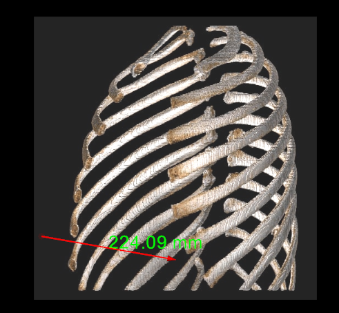 VTK 画箭头带长度测量_vtklinewidget2-CSDN博客