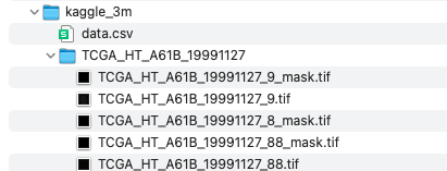 python_医学图像_brain MRI_数据集文件处理_lgg-mri-segmentation-CSDN博客