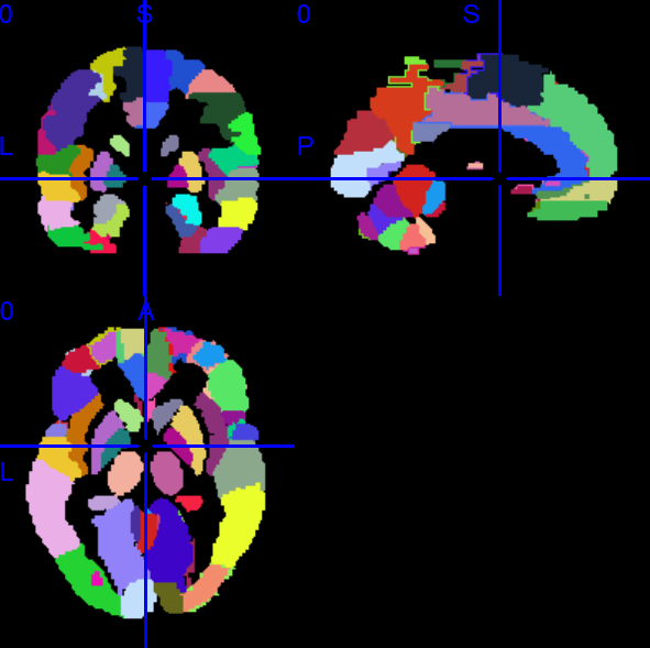 fMRI脑影像特征提取——Pearson相关与低阶功能连接LOFC（dpabi+nilearn）_静息态和任务态区别-CSDN博客