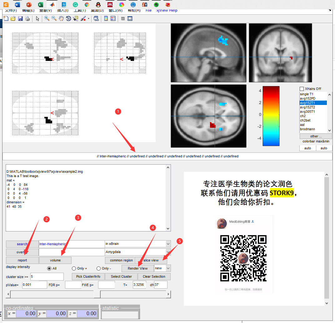 xjview脑区结果怎么看-CSDN博客