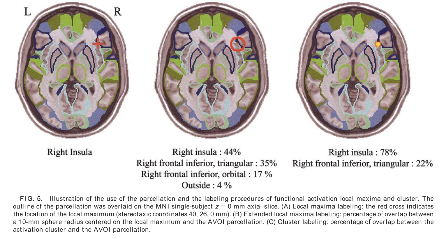 xjview脑区结果怎么看-CSDN博客