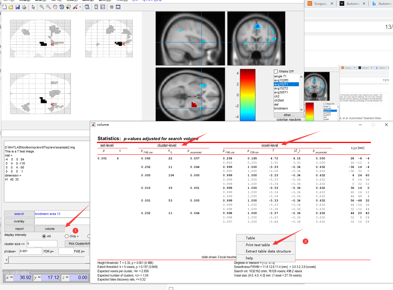 xjview脑区结果怎么看-CSDN博客