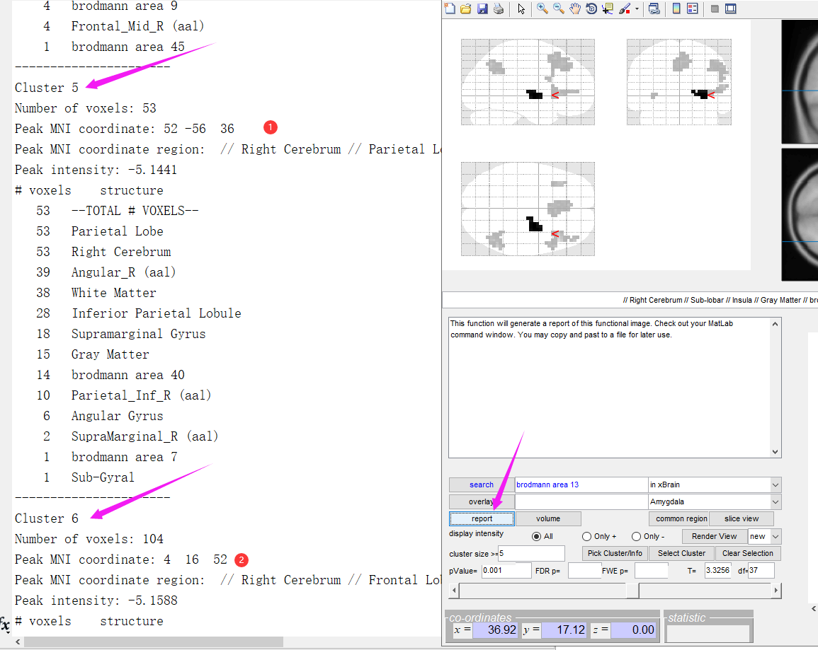xjview脑区结果怎么看-CSDN博客