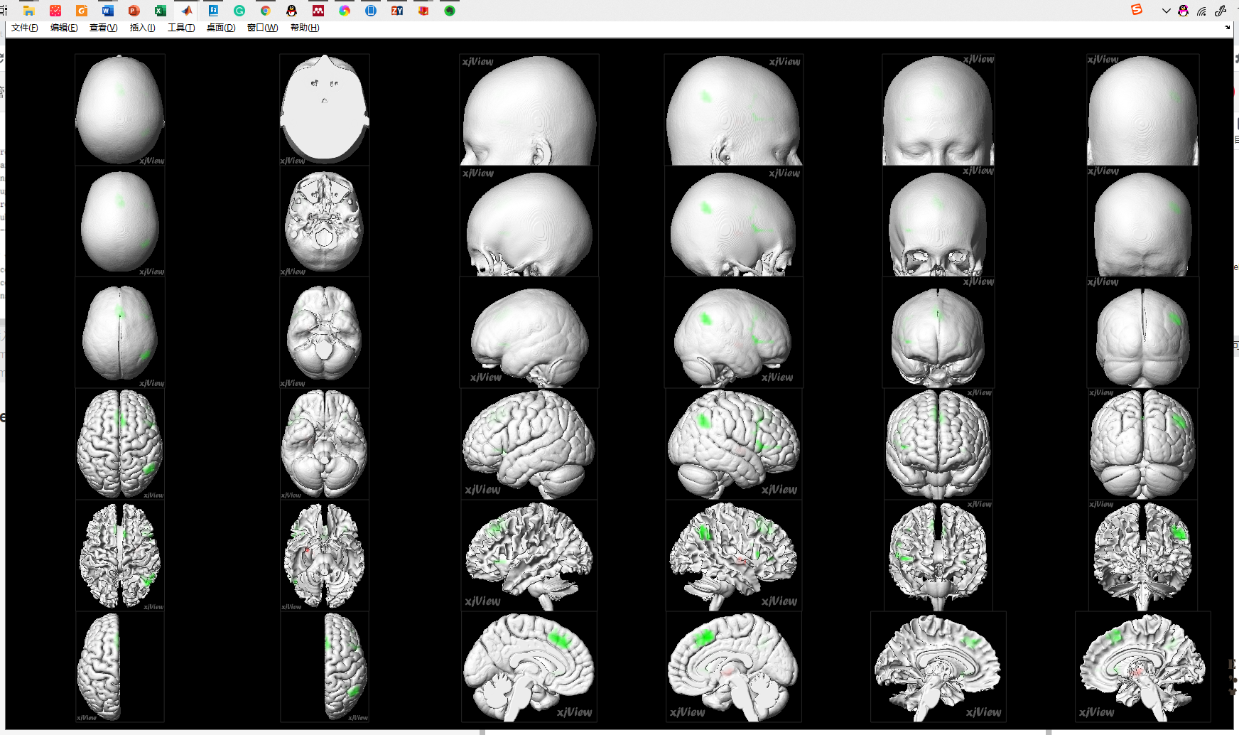 xjview脑区结果怎么看-CSDN博客